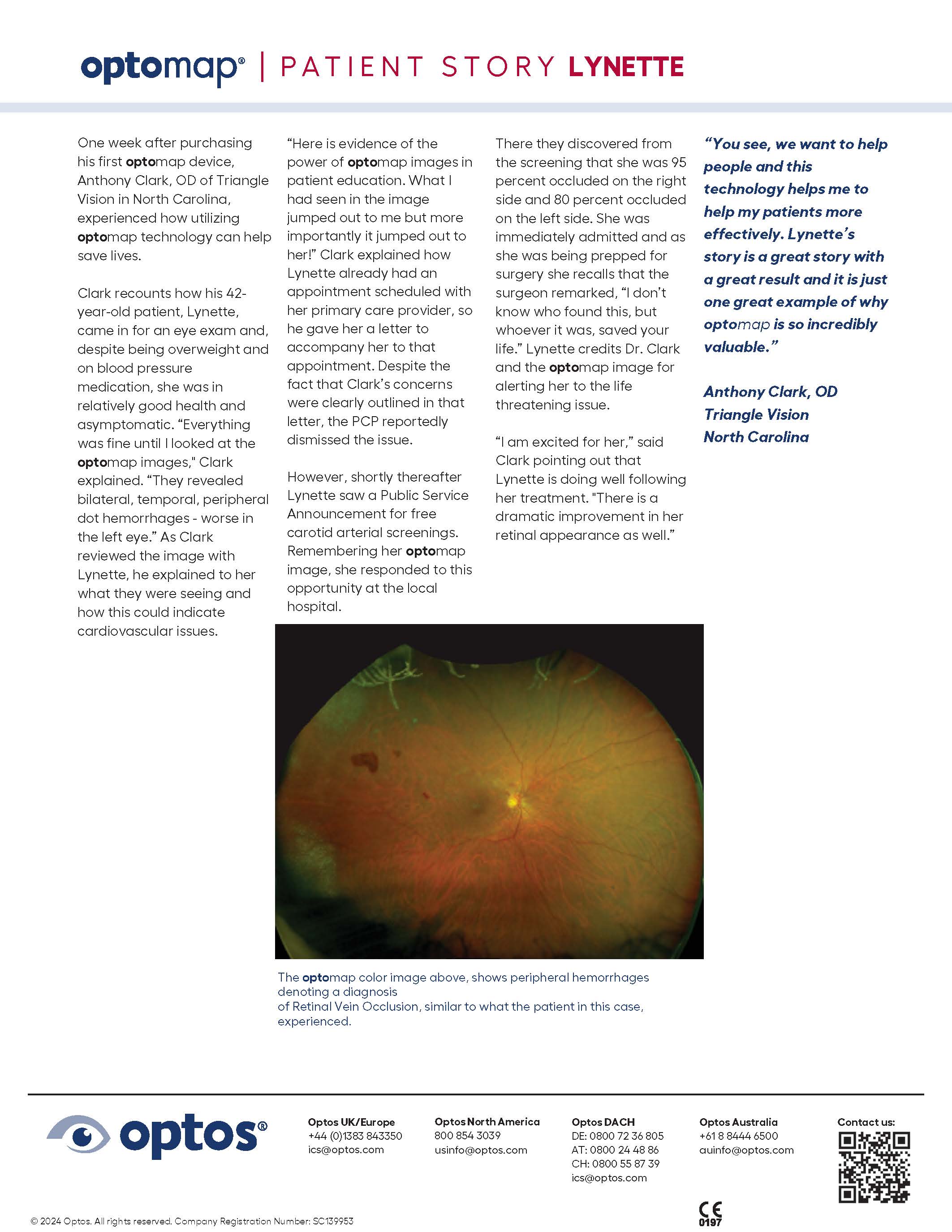 Ocular & Systemic Disease Detection | optomap Patient Stories