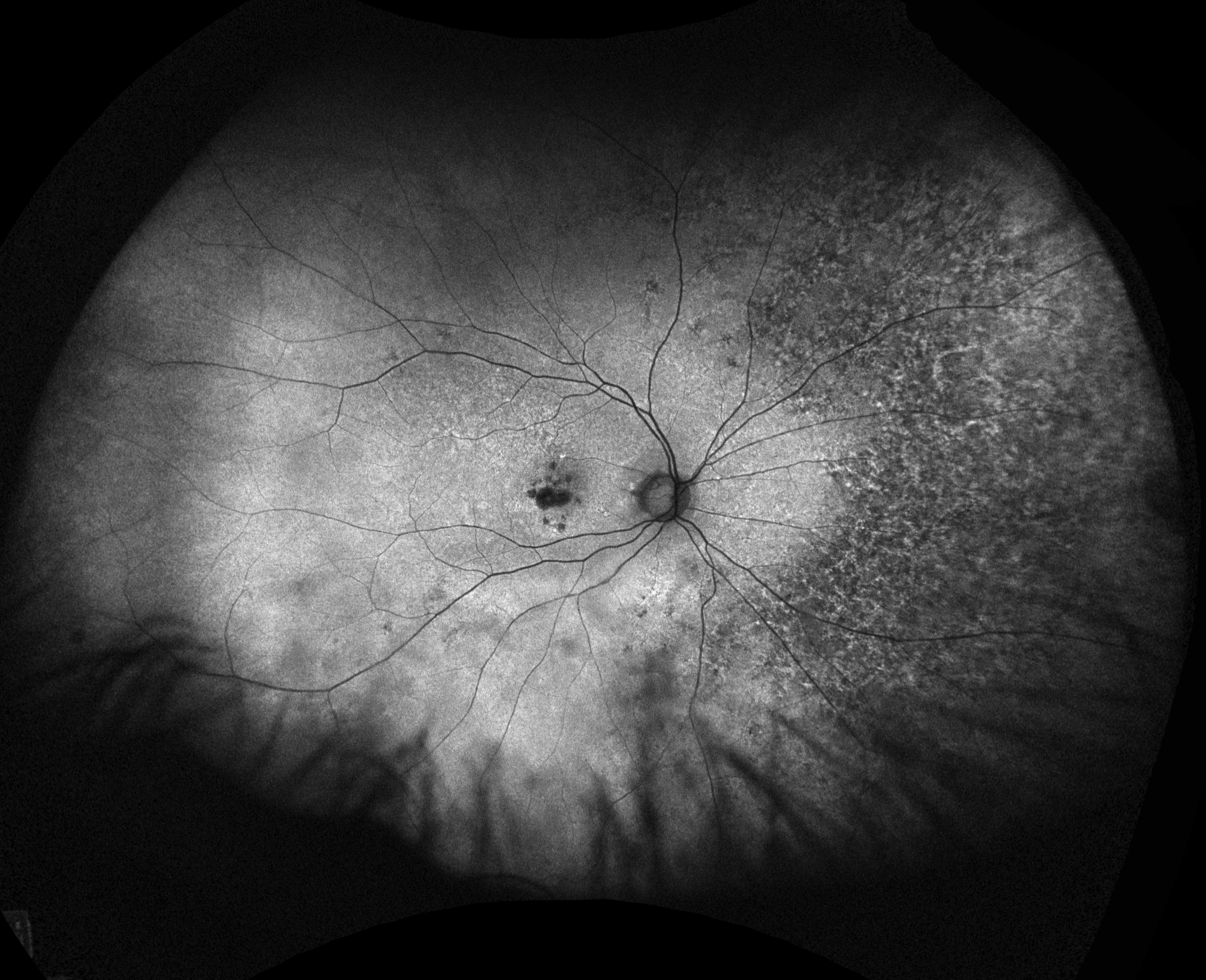 Optos Retinal Imaging Devices and Software Solutions | Learn More