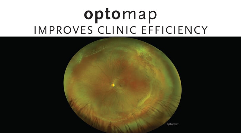 Clinical Papers and Research Using Optos Ultra-widefield Devices