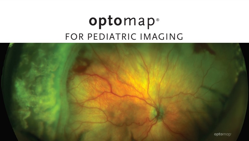 Clinical Papers and Research Using Optos Ultra-widefield Devices