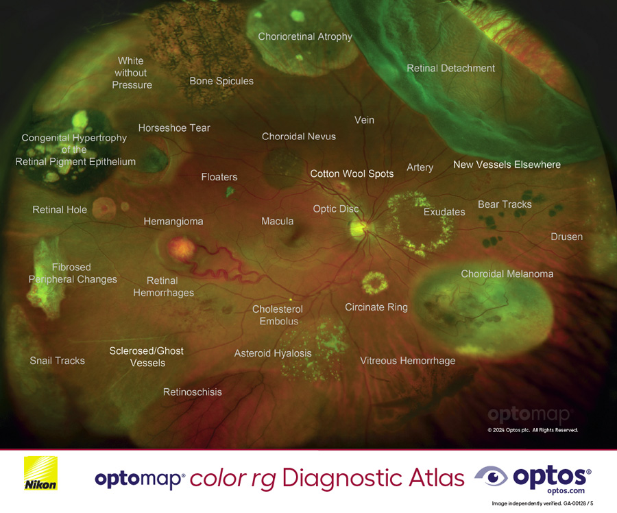 Diagnostic and Educational Tools for optomap | Access Materials