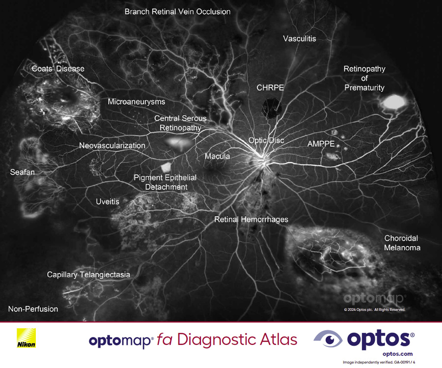 Diagnostic and Educational Tools for optomap | Access Materials