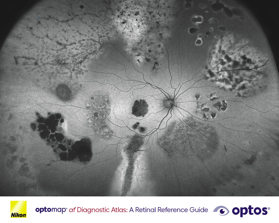 Diagnostic and Educational Tools for optomap | Access Materials