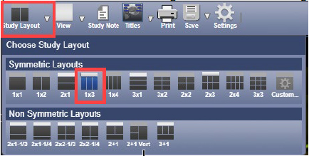Comparing Prior Images in OptosAdvance | Optos Support