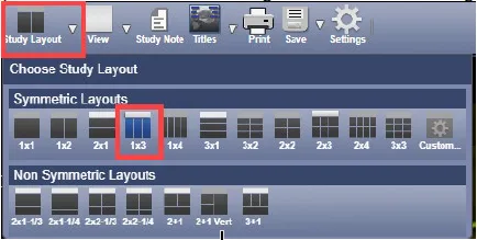 Comparing Prior Images in OptosAdvance | Optos Support