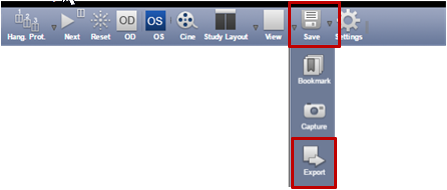 Export Images from OptosAdvance: All Formats | Optos Support