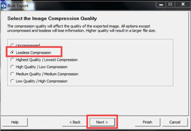 Comparing Prior Images in OptosAdvance | Optos Support