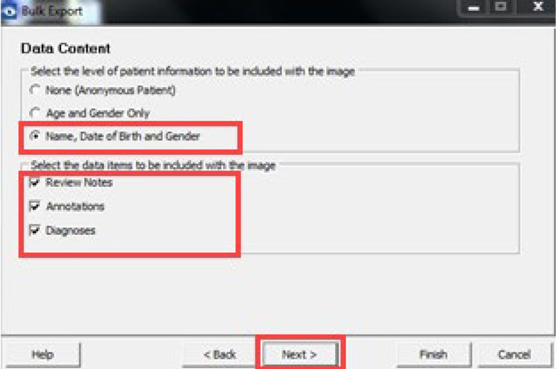 Comparing Prior Images in OptosAdvance | Optos Support