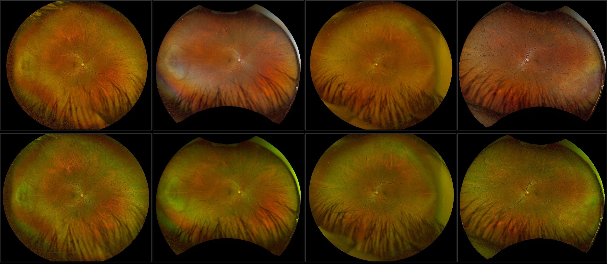 White without Pressure